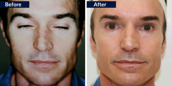 Patrick Bitter MD Treatments before-and-after photos